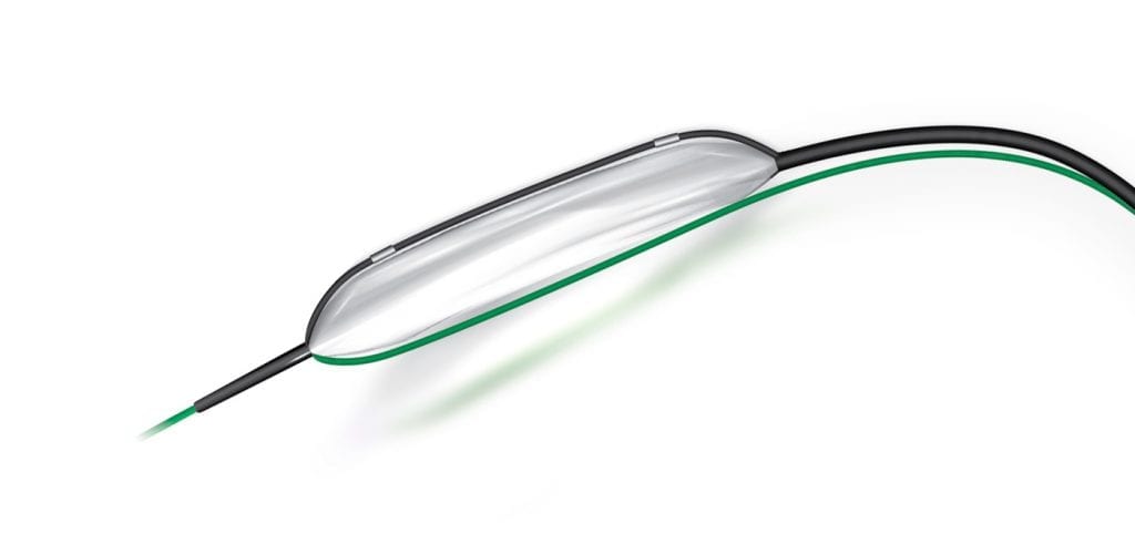 Scoreflex PTA - OrbusNeich