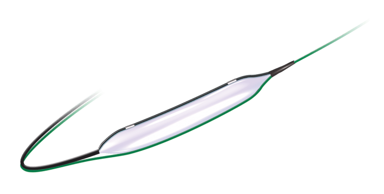 Scoreflex PTA - OrbusNeich