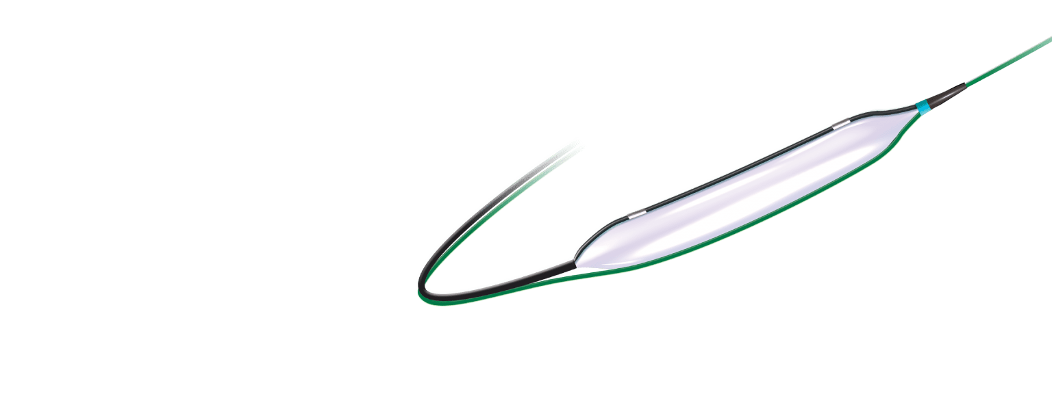 Scoreflex - OrbusNeich