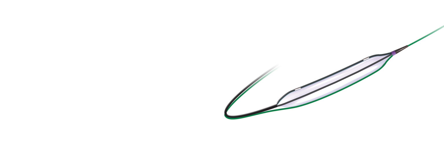 Scoreflex TRIO - OrbusNeich