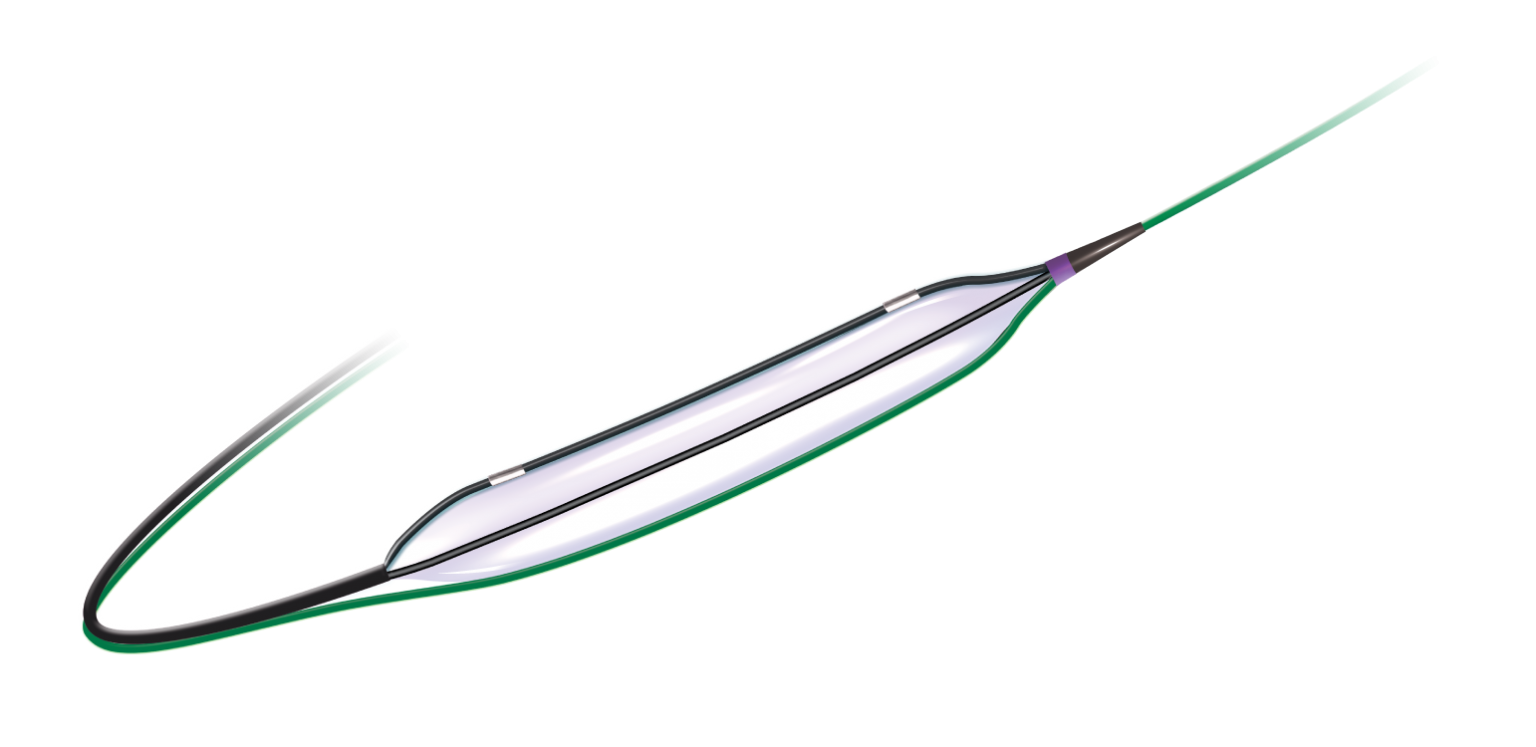 Scoreflex TRIO - OrbusNeich