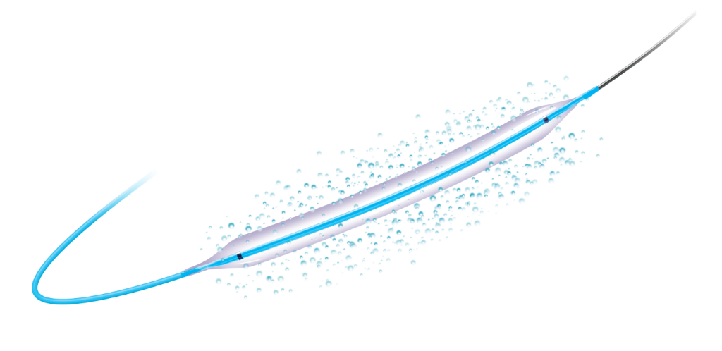 Coronary Portfolio - OrbusNeich