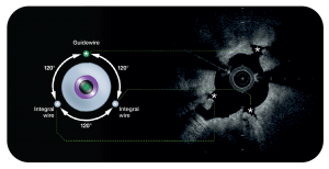 Scoreflex TRIO - OrbusNeich