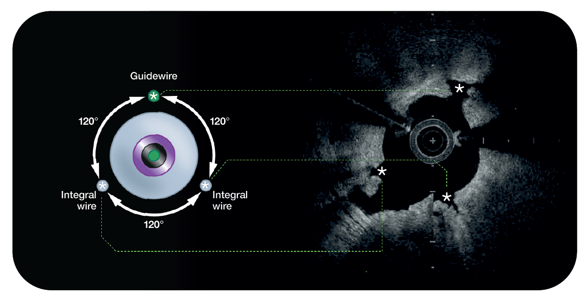 Scoreflex TRIO - OrbusNeich